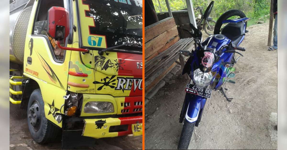 Ditabrak Truk Pemotor di Margomulyo Bojonegoro Alami Patah Kaki ... Ditabrak Truk Pemotor di Margomulyo Bojonegoro Alami Patah Kaki ...
